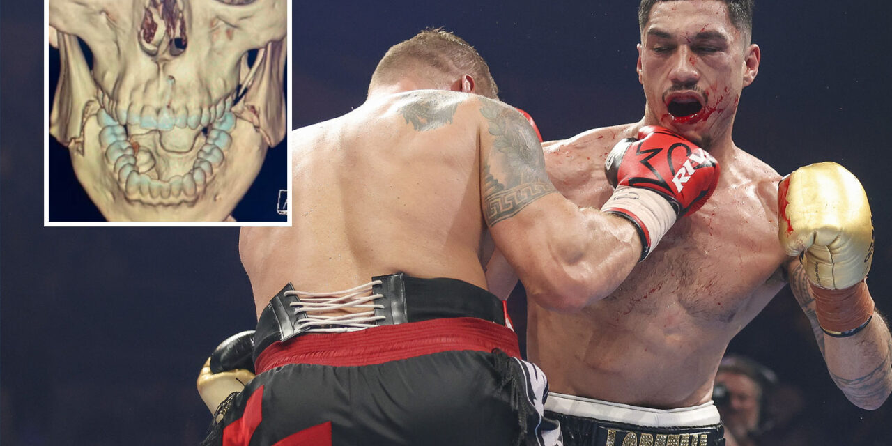 El boxeador Opetaia comparte una aterradora radiografía de la horrible ...