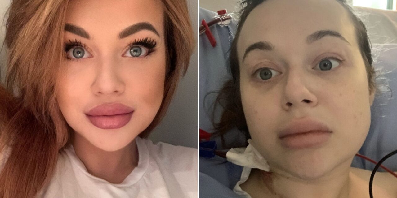 Me desmayé en el frente después de una noche de borrachera, terminé con ...